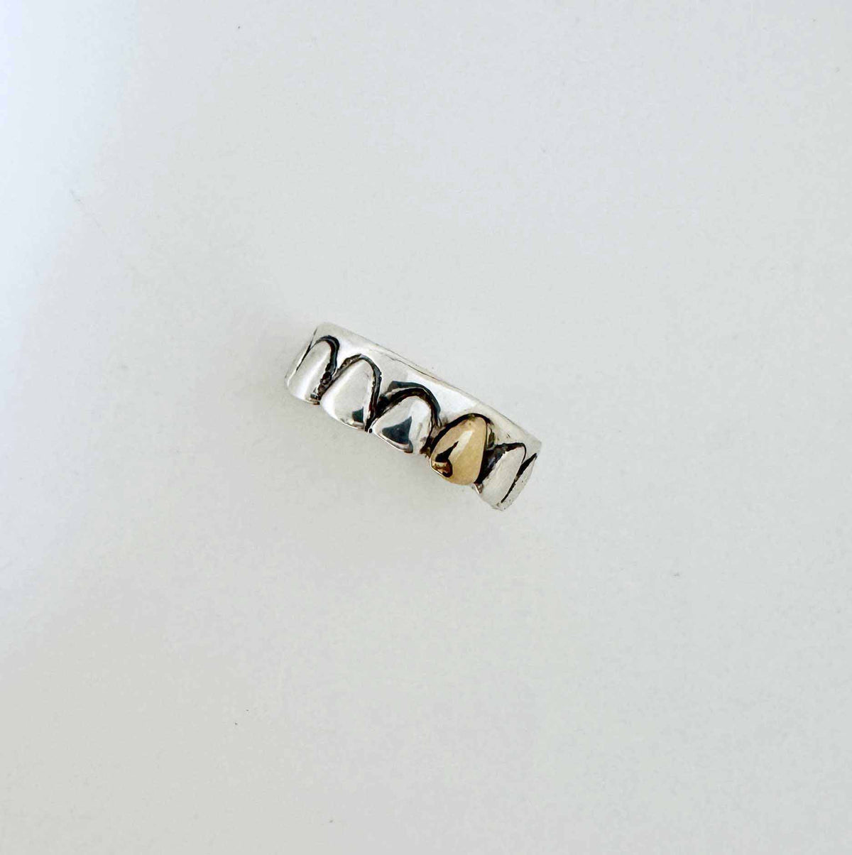 Gold Tooth Ring – Anomaly