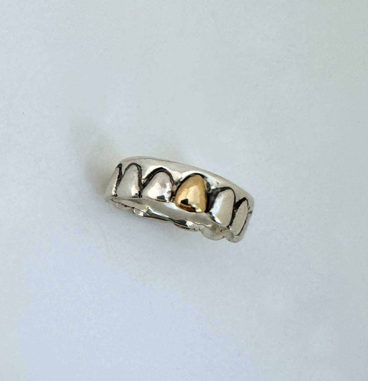 Gold Tooth Ring – Anomaly